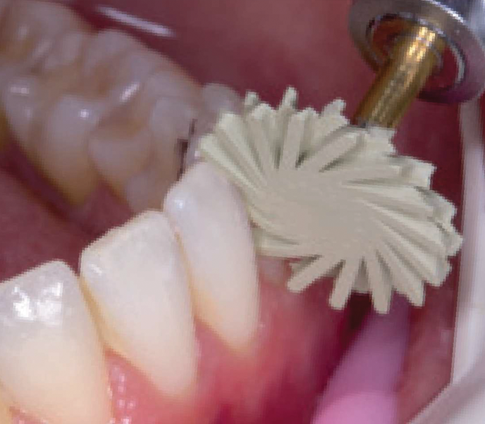 EVE The Simplification Of Polishing | Trycare, UK