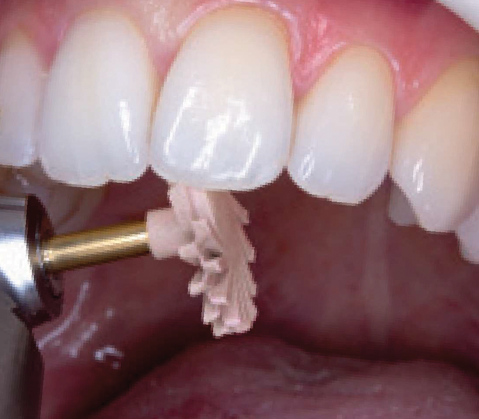 EVE The Simplification Of Polishing | Trycare, UK