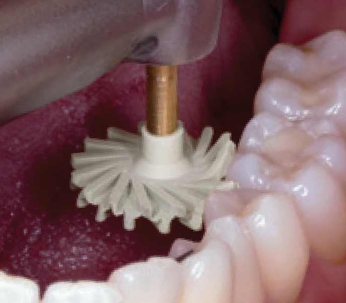 EVE The Simplification Of Polishing | Trycare, UK