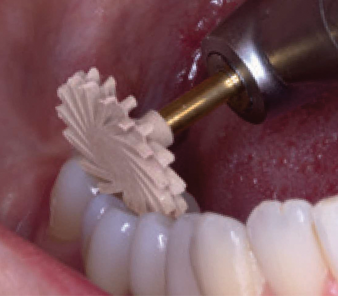 EVE The Simplification Of Polishing | Trycare, UK